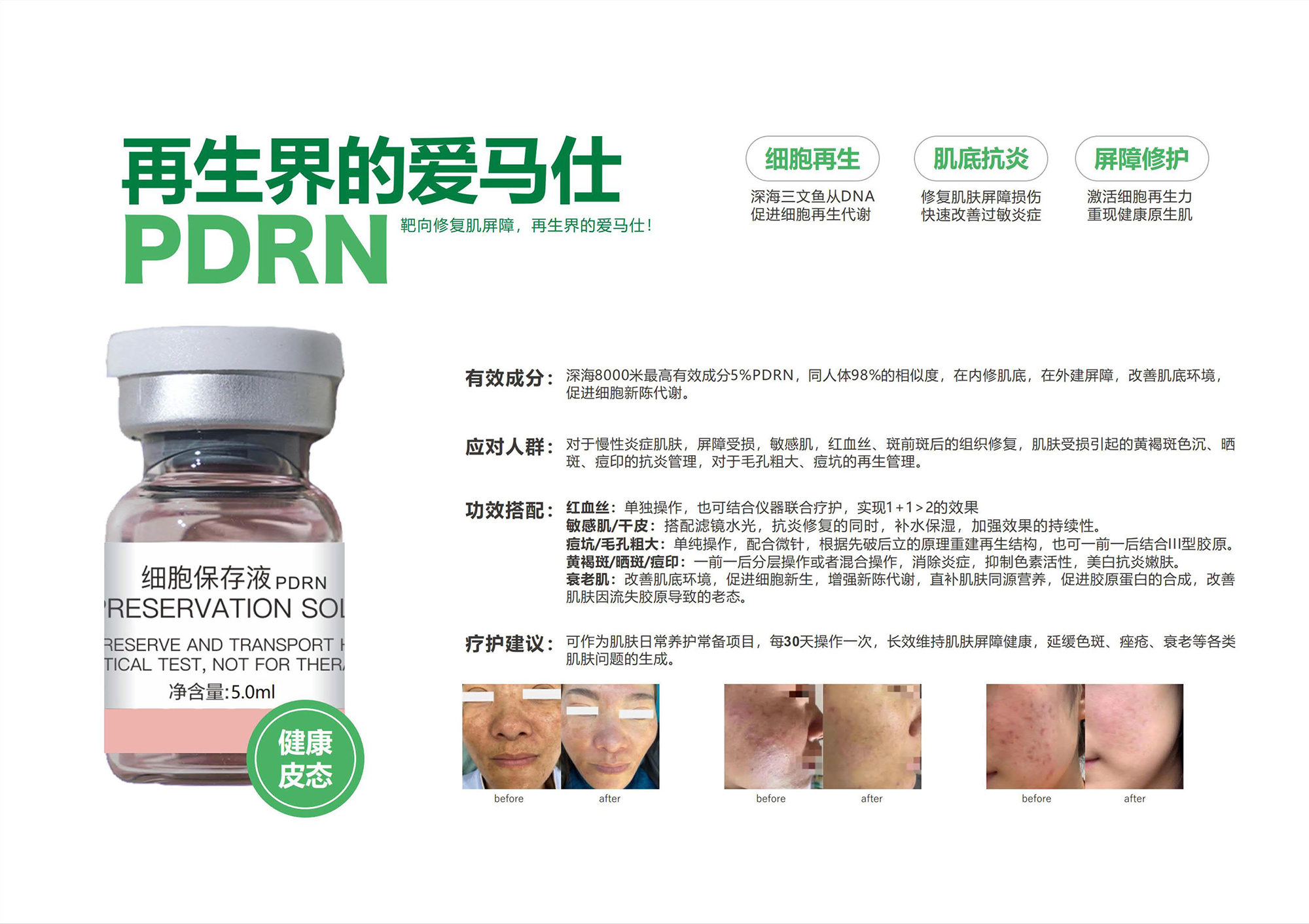 PDRN水光-（修复类）